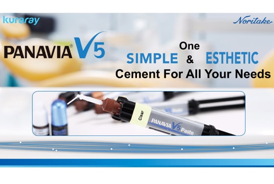 Dental Bonding Cement Case Studies | Panavia
